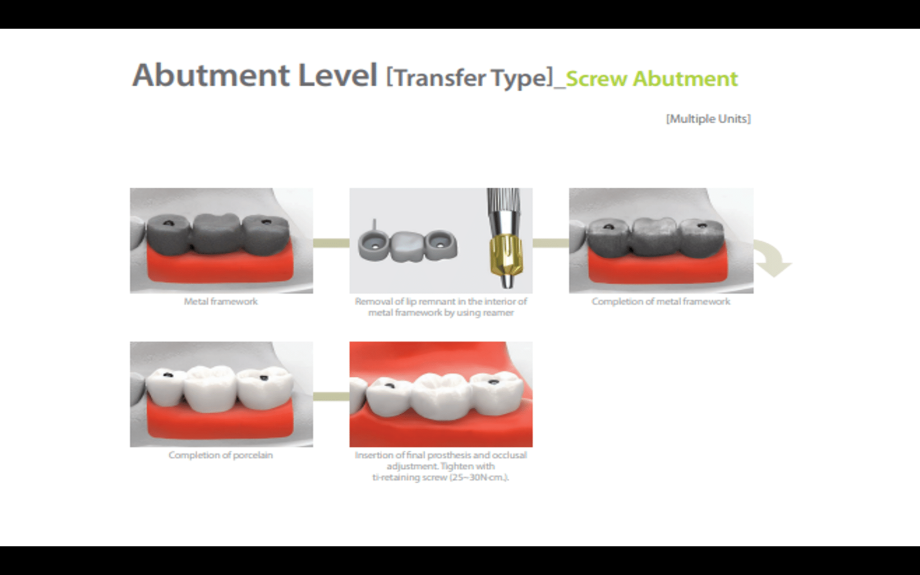 Screw Abutment Impression techniques & restoration selection in Dentium Implants